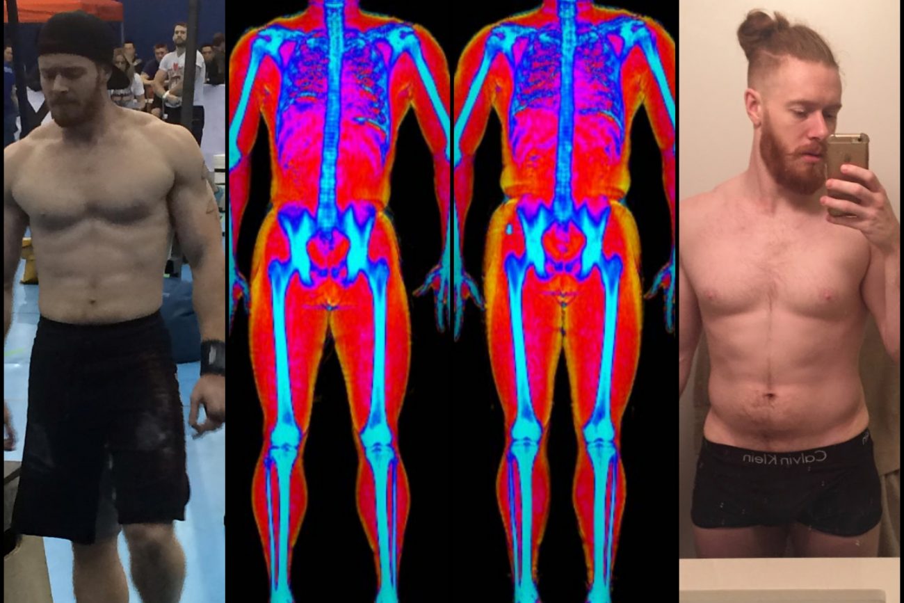 What Is A Dexa Scan For Body Fat At Nilsa Sutton Blog What Is A Dexa Scan For Body Fat At Nilsa Sutton Blog